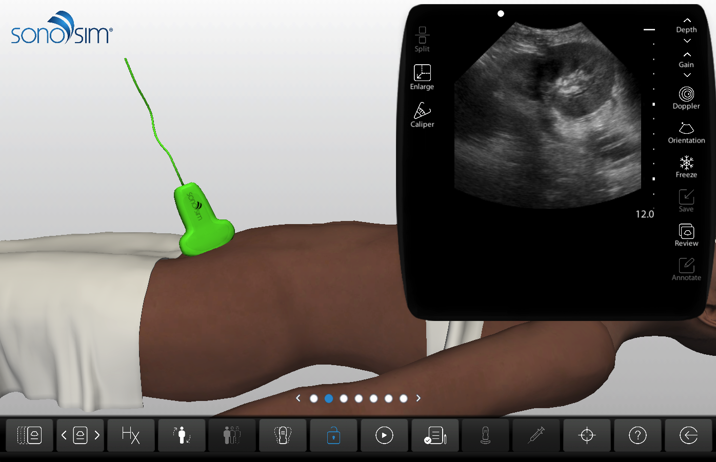 SonoSim May 2023 Release Overview